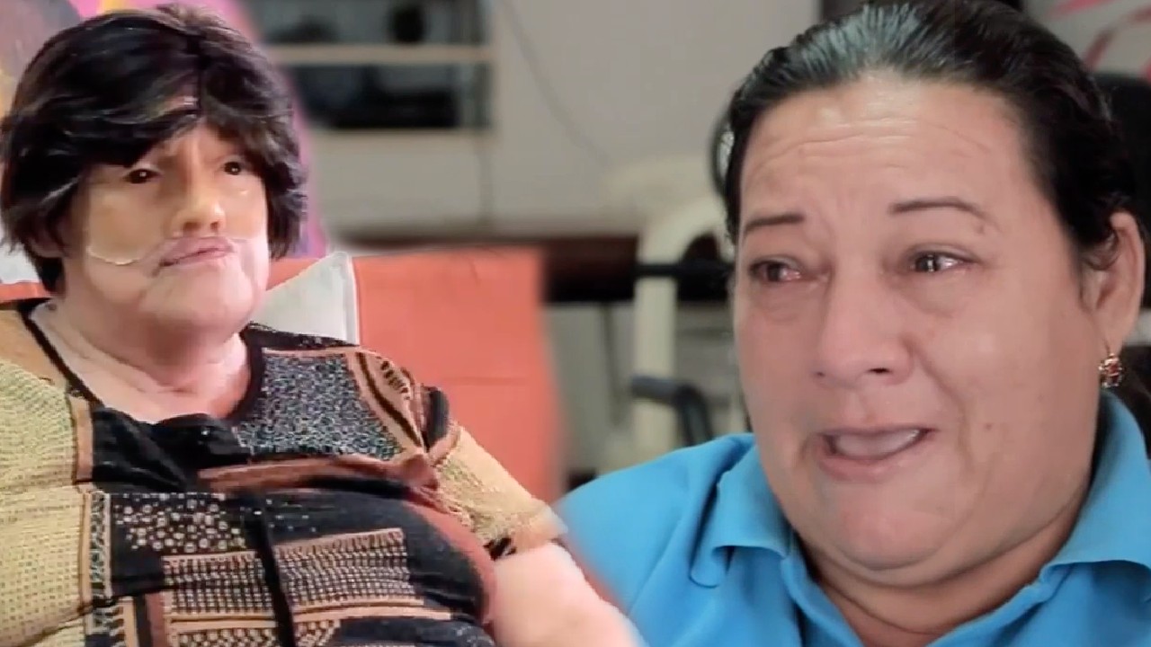 Conoce la conmovedora historia de “La Mujer sin Rostro” - Cachicha.com Conoce la conmovedora historia de “La Mujer sin Rostro” - Cachicha.com