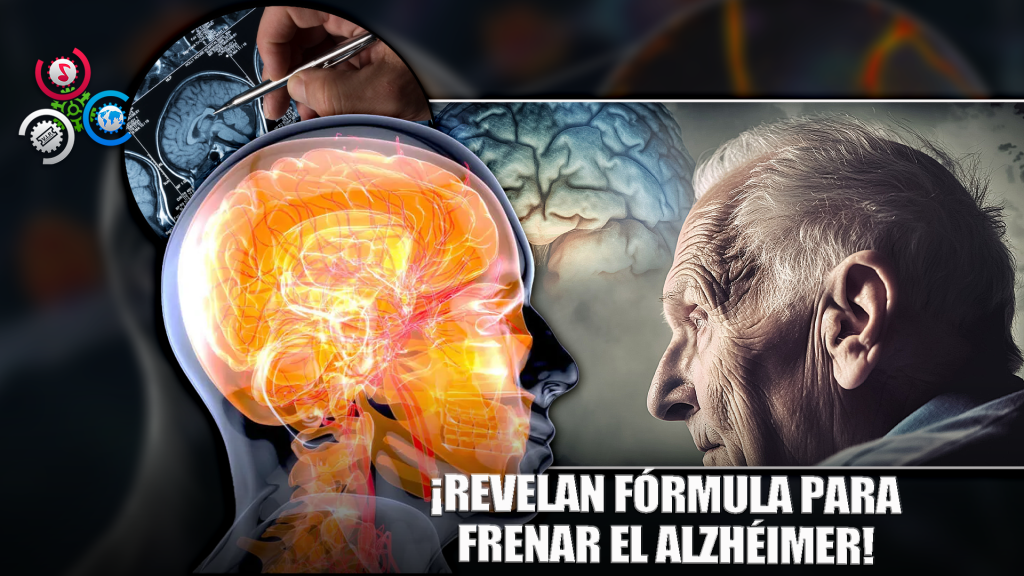 Estudios sobre el alzhéimer muestran cómo se puede retrasar el ...