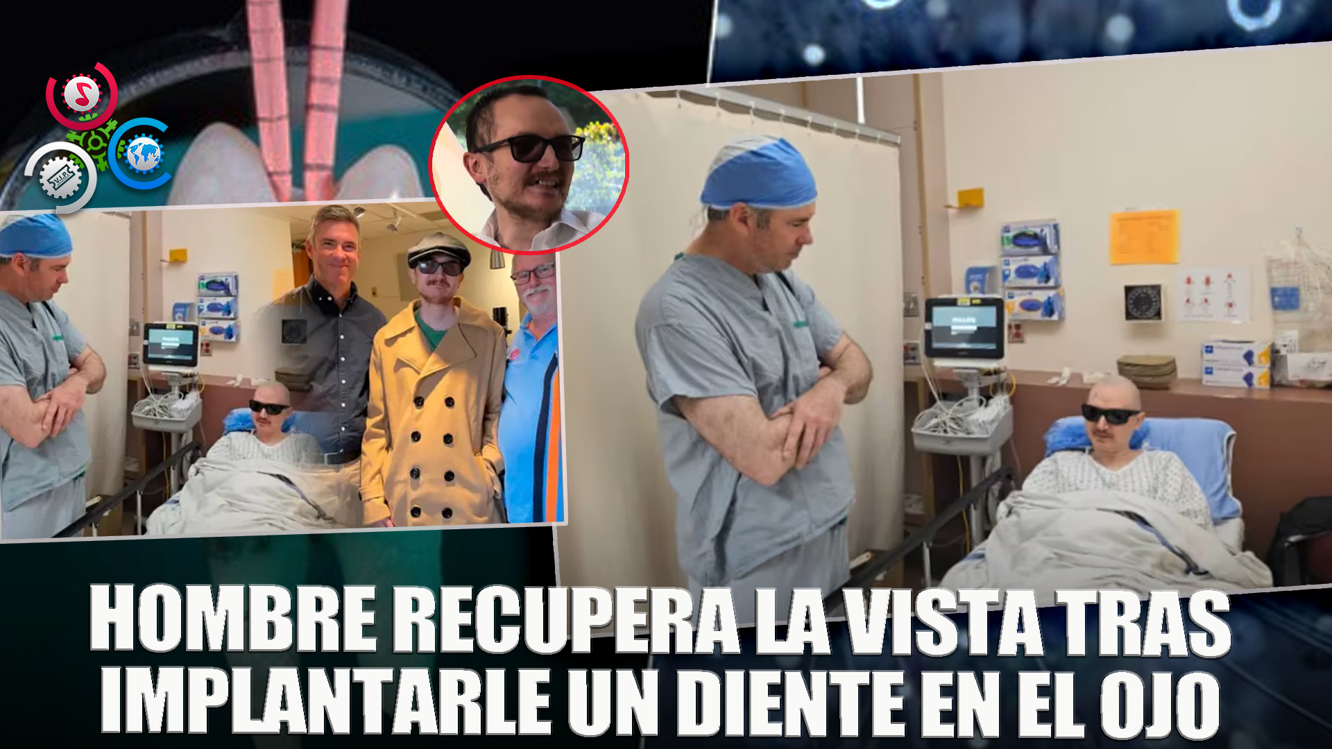 INCREÍBLE | Le implantan un diente en el ojo y vuelve a ver después de ...