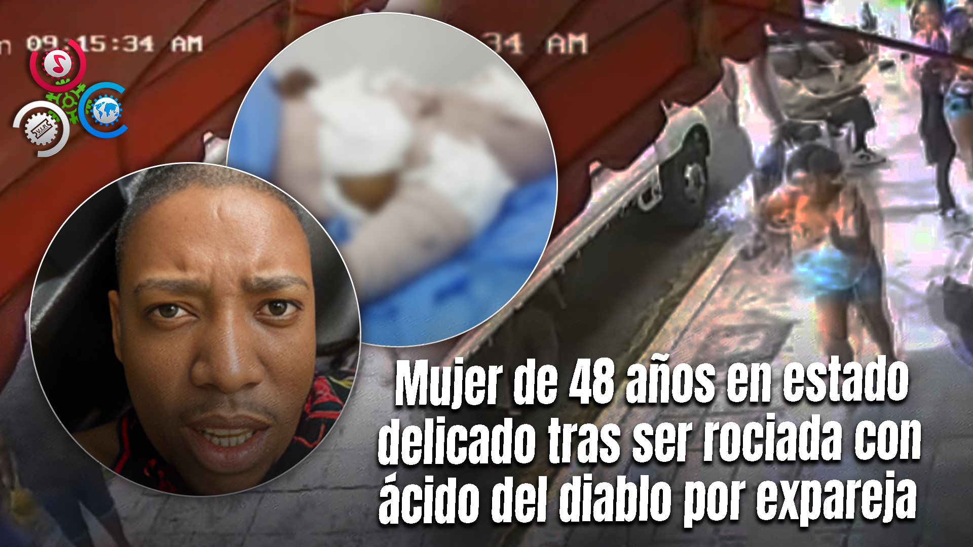 Mujer de 48 años es quemada con ácido del diablo por su expareja ...